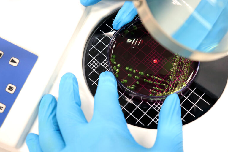 Bacterial count in next-generation probiotics: AFU technology - Biose ...